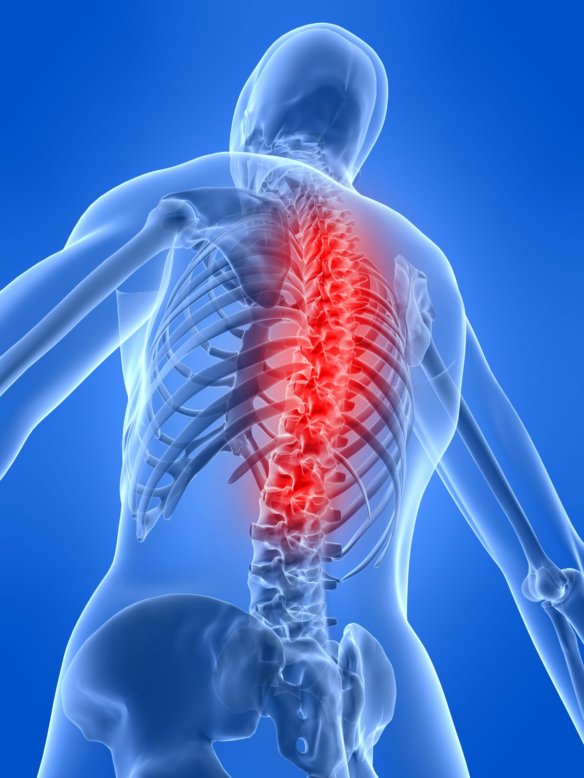 Mid-back Pain – AG Pain Management TX